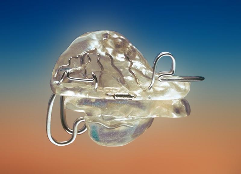 orthodontie.startpagina.nl - alles weten over orthodontie