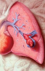 Longembolie Startpagina - informatie over longembolieën