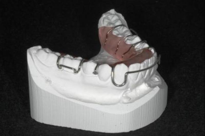 orthodontie.startpagina.nl - alles weten over orthodontie